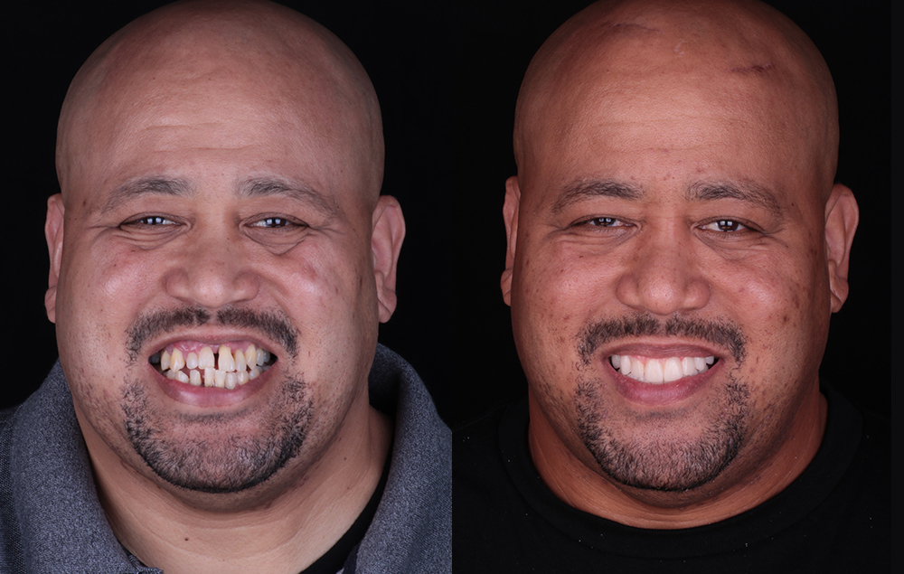 Center For Advanced Periodontal & Dental Implant Therapy Los Angeles